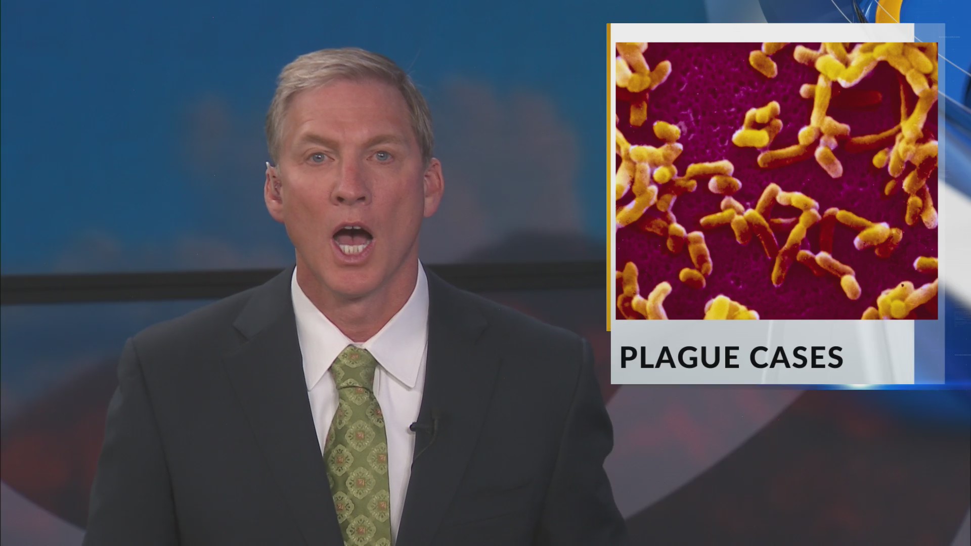 What to know about human and animal plague in New Mexico – KRQE NEWS 13 ...
