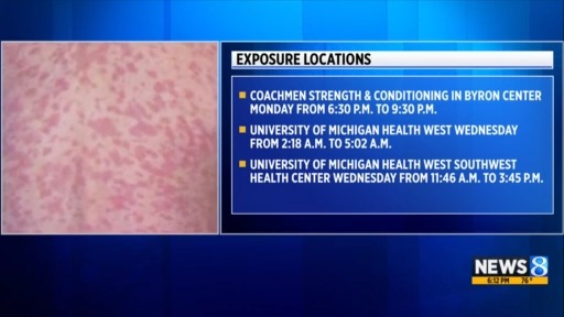 Measles case confirmed in Allegan County – WOODTV.com
