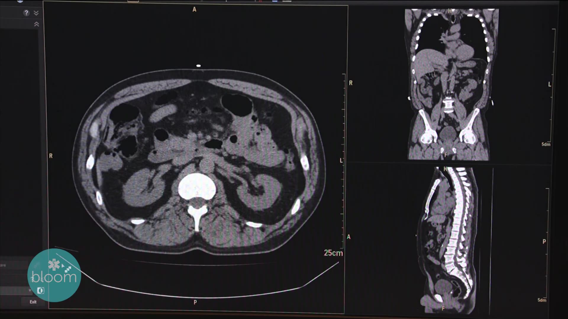 Life Guard Imaging Tampa’s PREMIER scan facility – WFLA