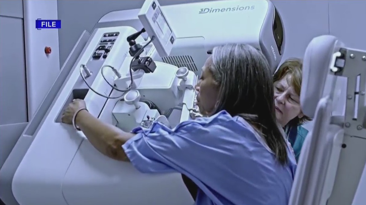 Mammograms starting at 40 will reduce deaths from breast cancer: Doctor ...