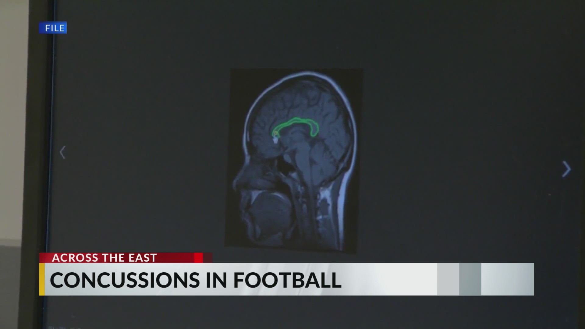 ECU Health doctor speaks on football injury risks – WNCT