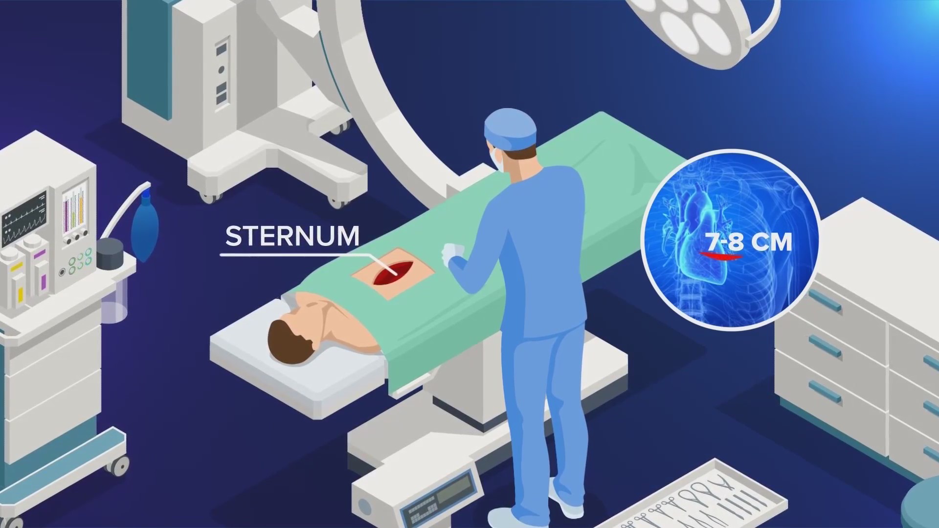 Bypassing a big incision: Less invasive approach to open-heart surgery ...