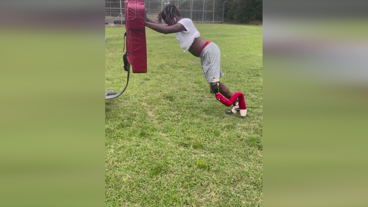 Football player with prosthetic leg – WKRG News 5