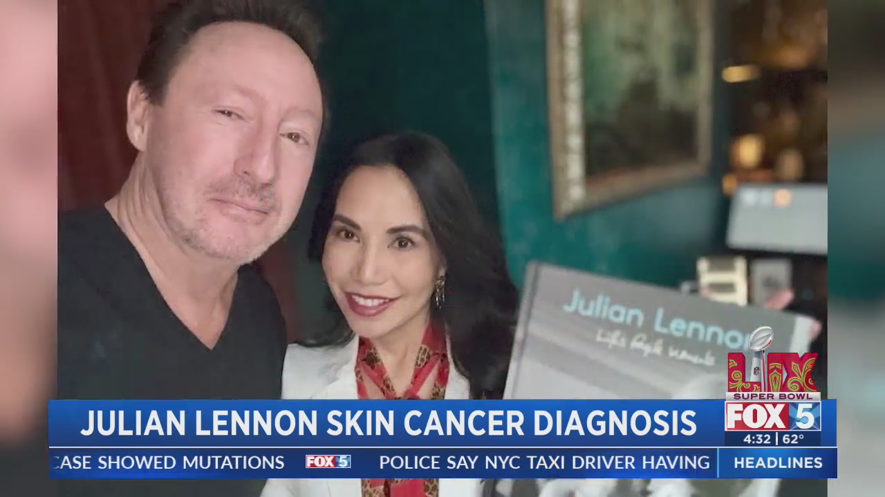 John Lennon’s son Julian learns skin cancer diagnosis – FOX 5 San Diego ...