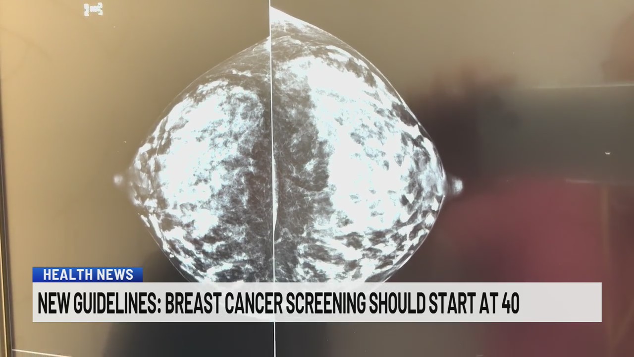 New guidelines: Breast cancer screening should start at 40 – NEWS10 ABC