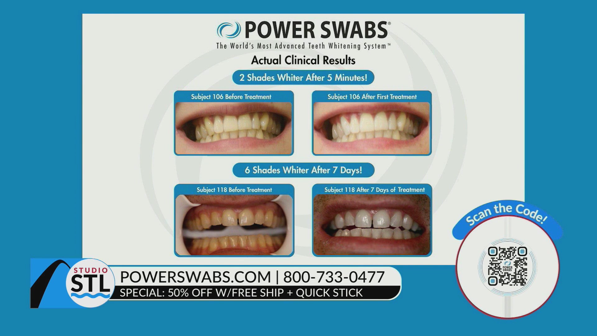 Get 50% off and free shipping for teeth whitening with Power Swabs! – FOX 2