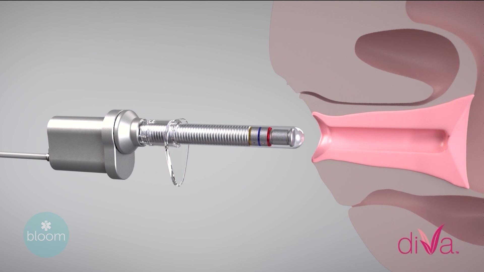 Intimate Rejuvenation: Bringing restoration to vaginal health | Bloom ...