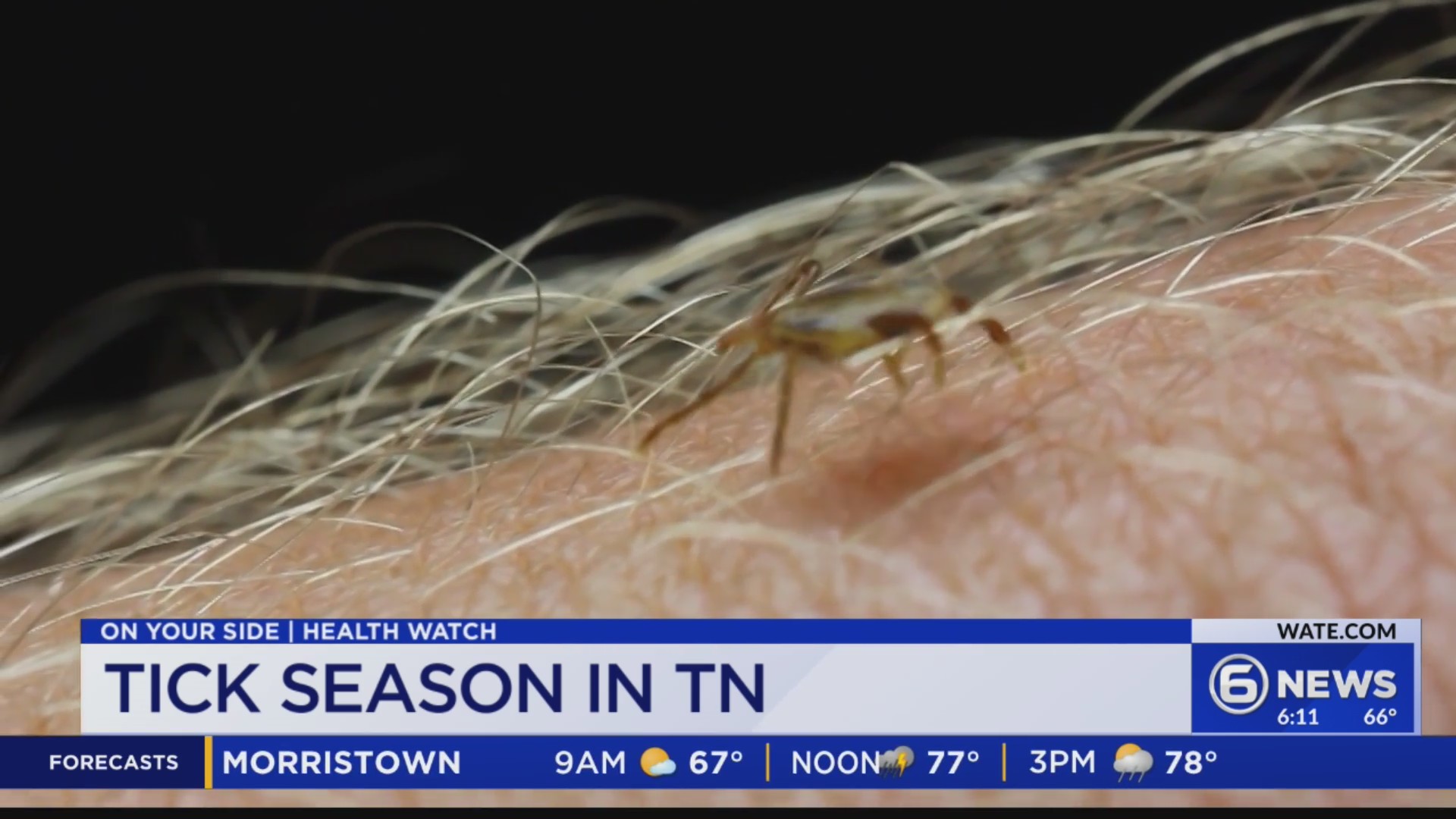 What to know about tick season in Tennessee – WATE 6 On Your Side