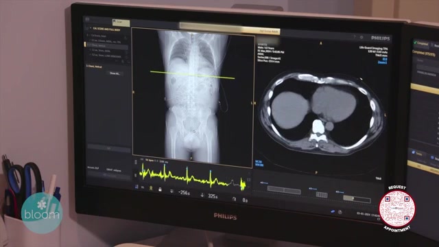 Different between CT and MRI scans | Bloom – WFLA