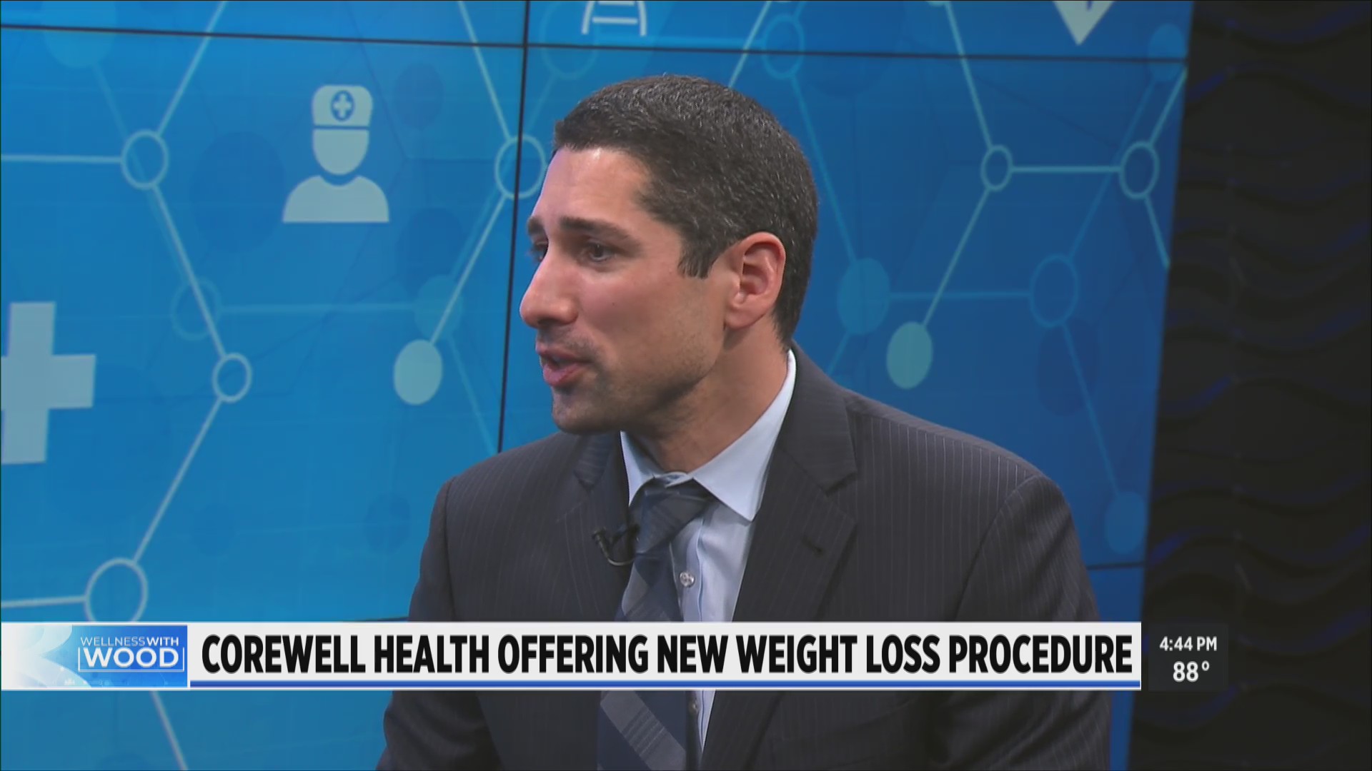 Corewell Health offers new weight loss procedure – WOODTV.com
