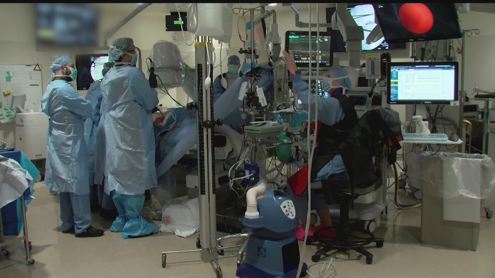 New surgery technique quickens recovery from kidney stones – WYTV