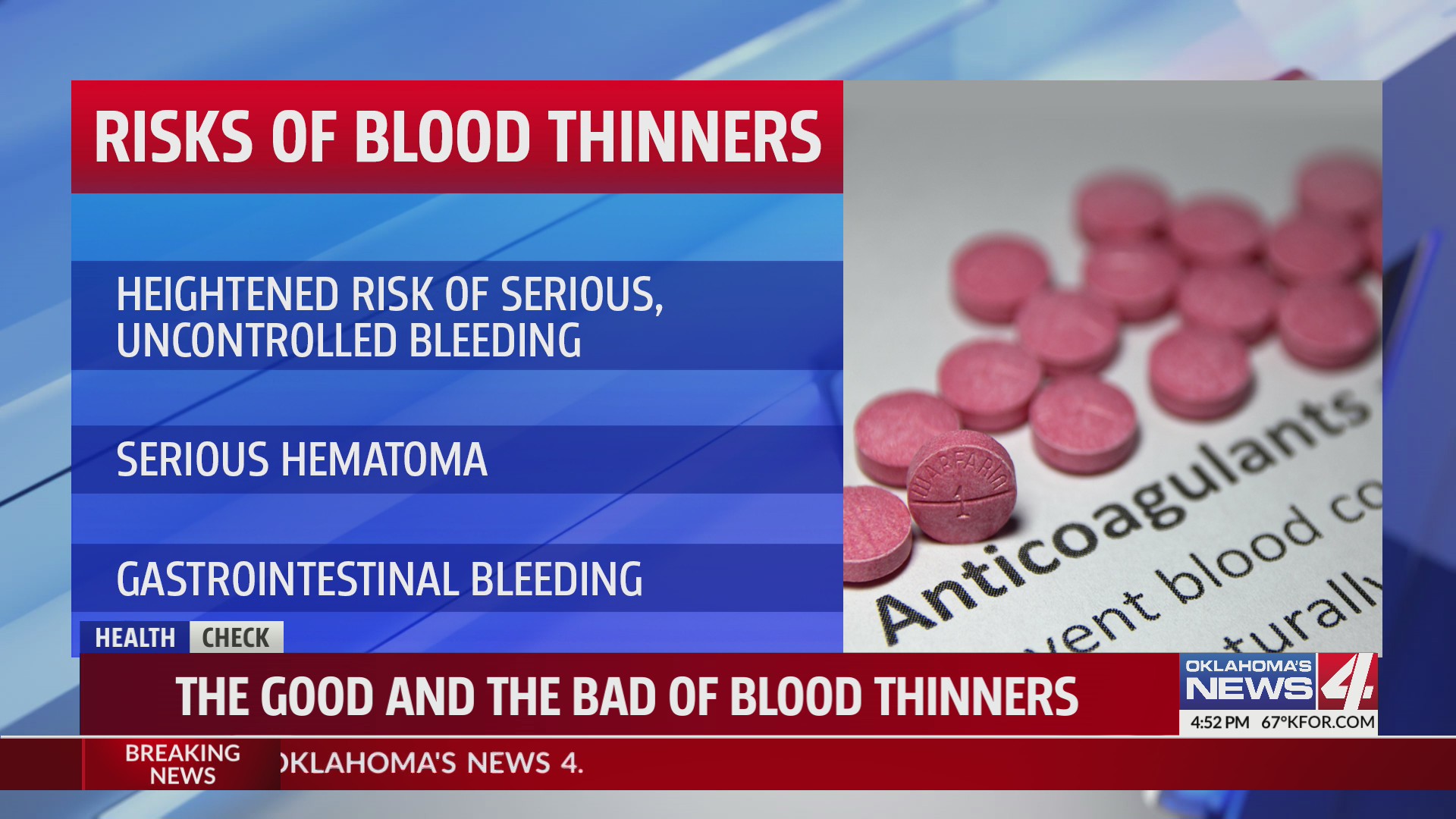 The good and the bad of blood thinners – KFOR.com Oklahoma City