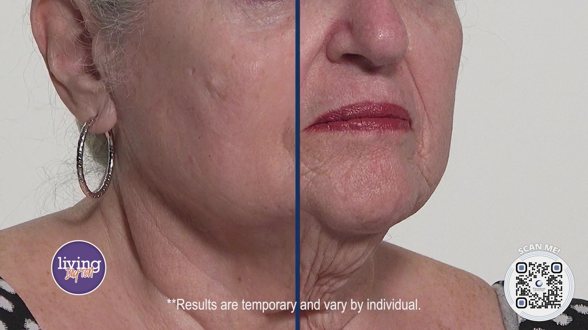 Pleaxaderm can help you look younger in just minutes! – WDTN.com