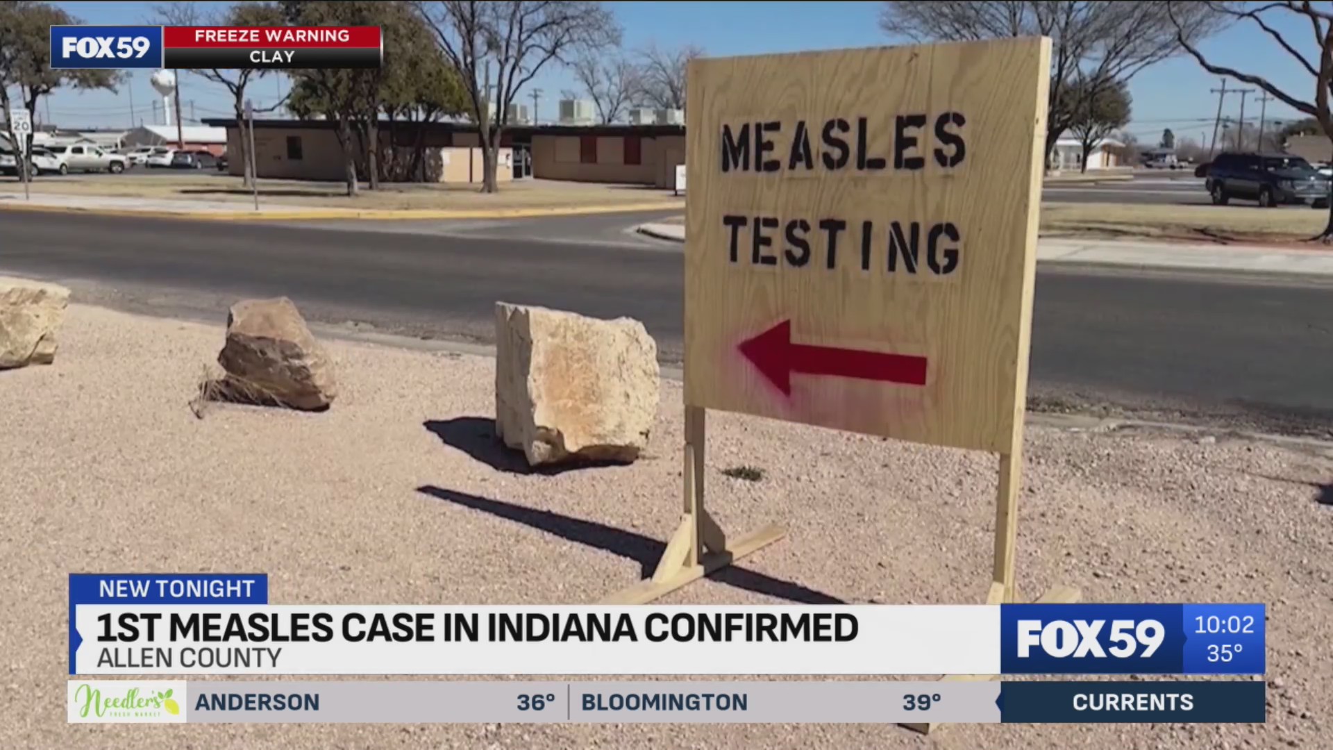 First Indiana Measles case confirmed in Allen County – Fox 59