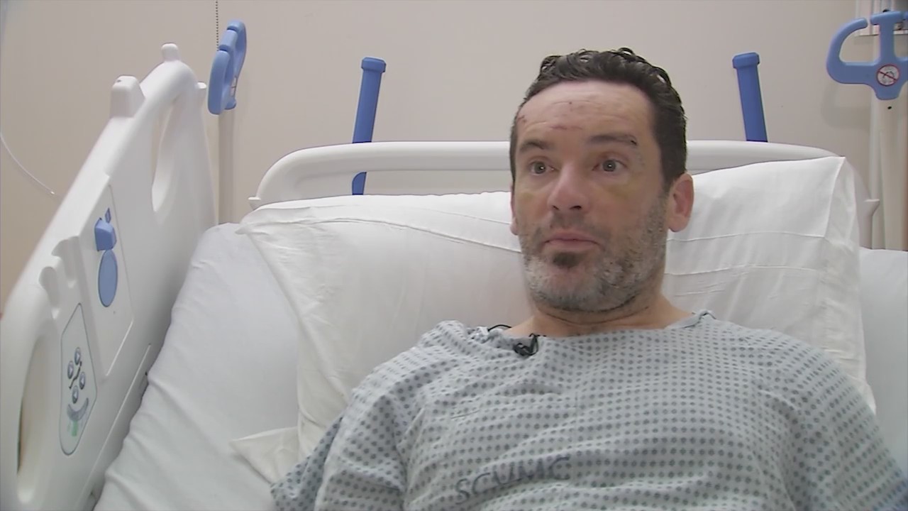 VTA attack victim speaks out – KRON4