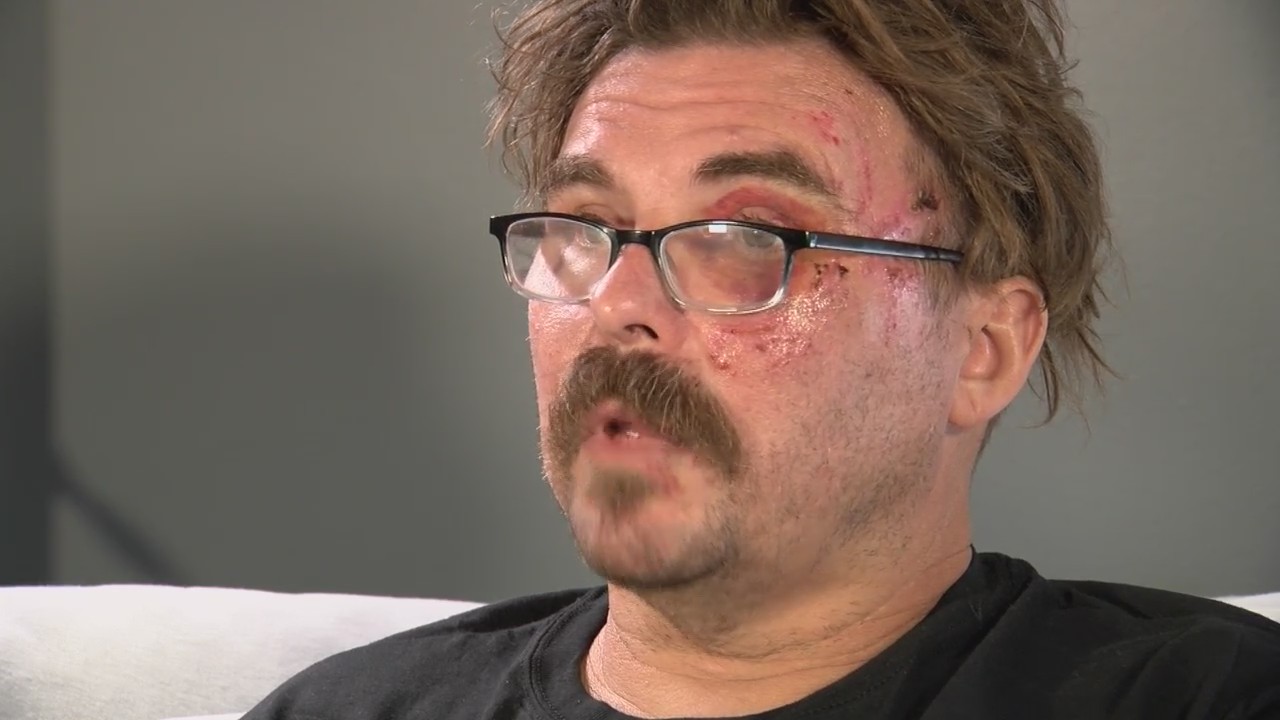 Man who lived through Fordyce mass shooting speaks after trying to stop ...