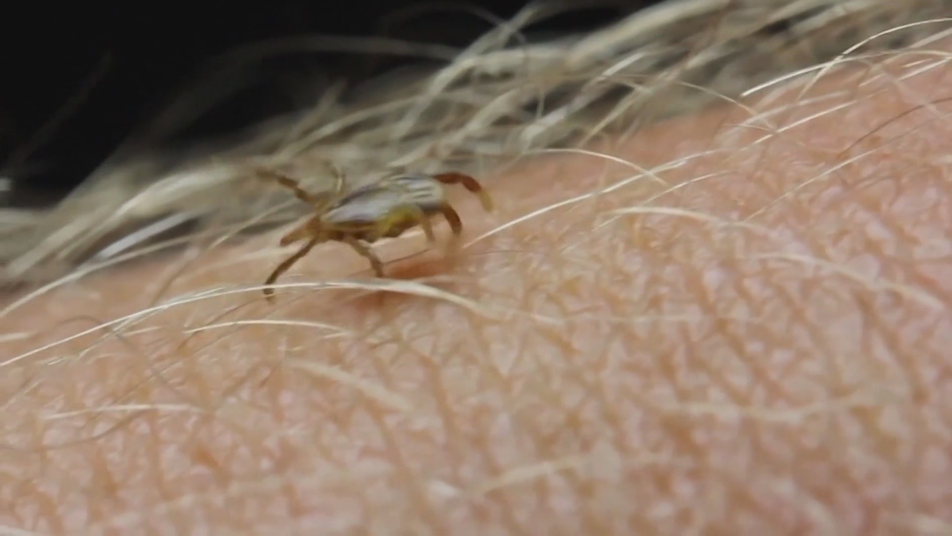 Tick bite at golf course sends STL man to ICU – FOX 2