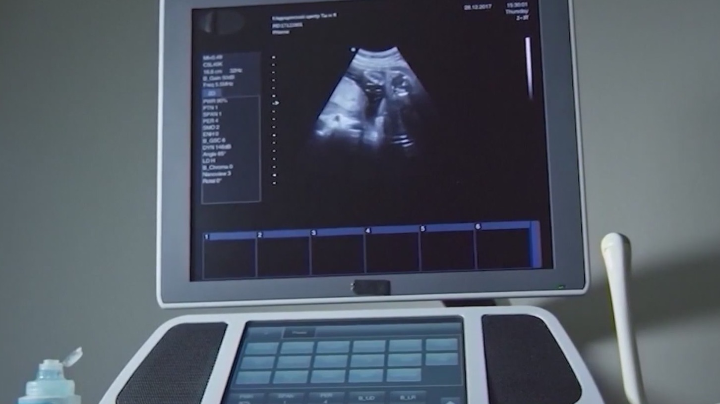 Texas Medical Board examines exceptions to state’s abortion – KXAN Austin