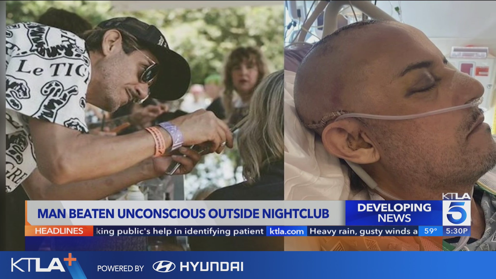 Man beaten unconscious outside West Hollywood nightclub. – KTLA