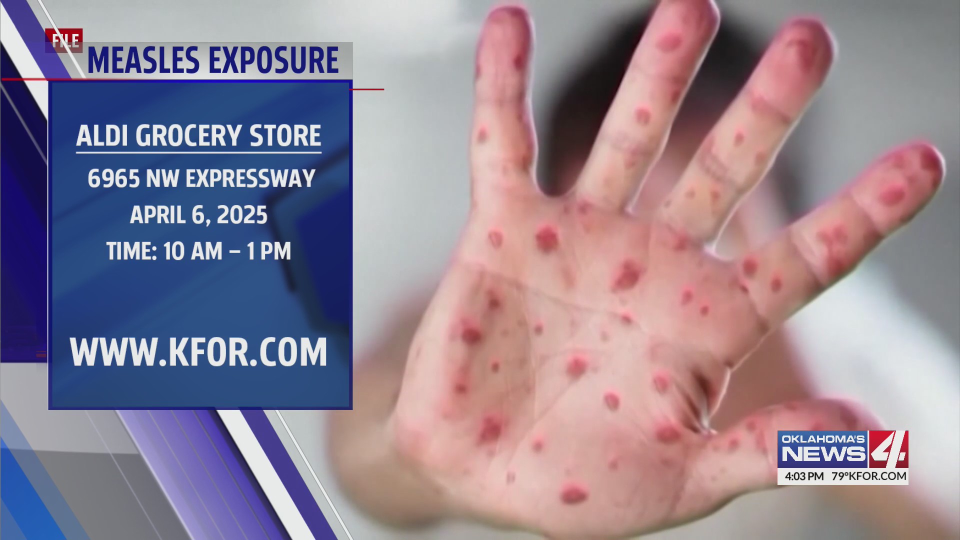 OSDH identifies potential measles exposure site in OKC connected to ...