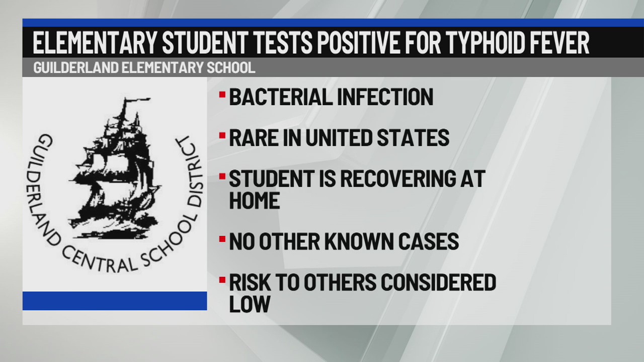 Guilderland elementary student tests positive for typhoid fever ...
