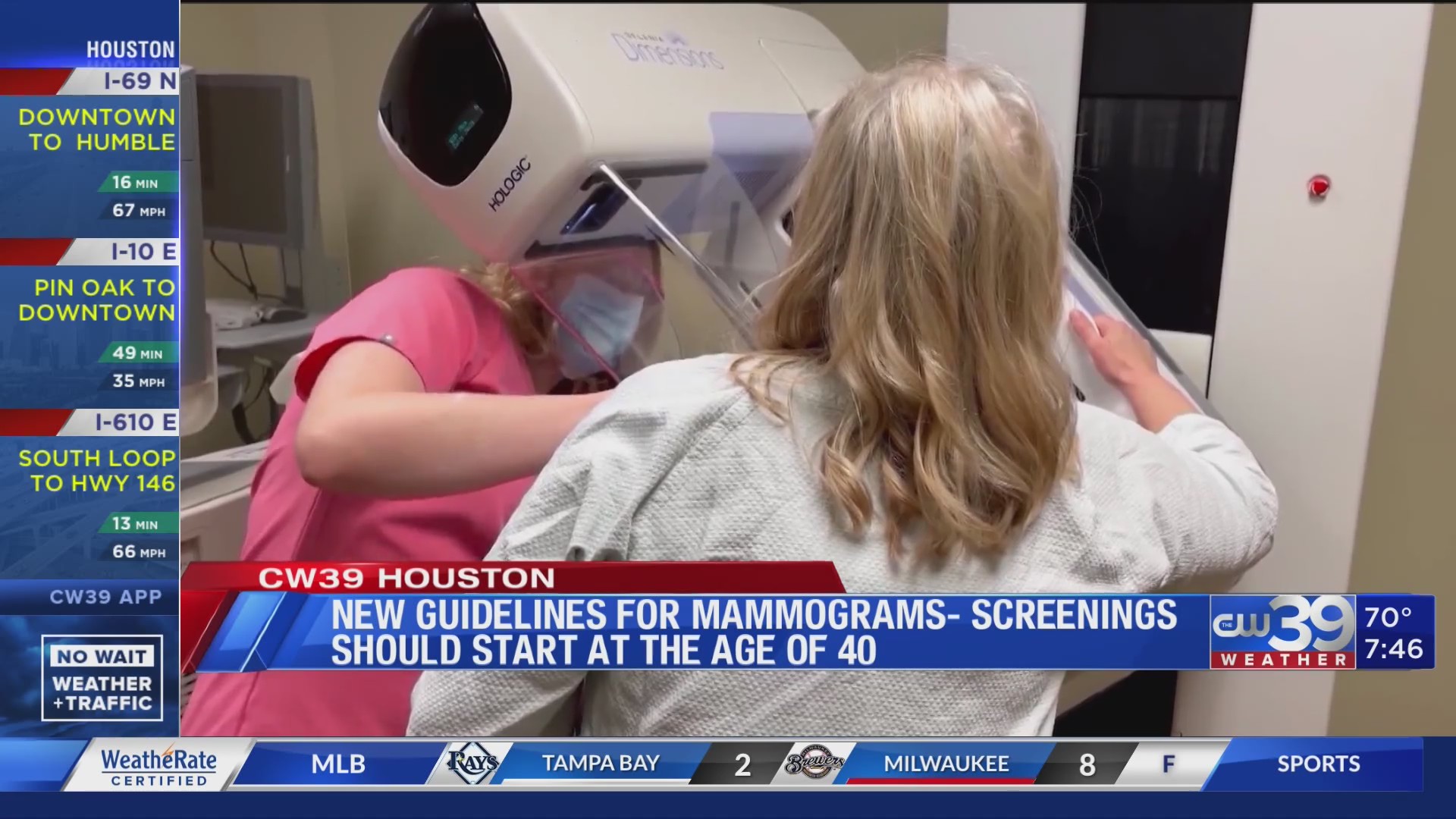 Mammograms should start at 40 to address rising breast cancer rates at ...
