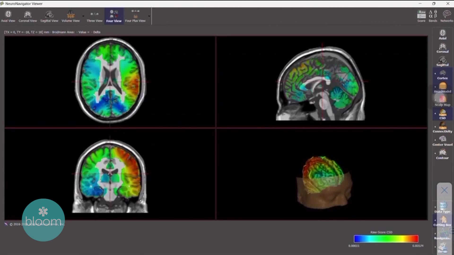 Genesis Brain Institute is transforming lives through advanced ...