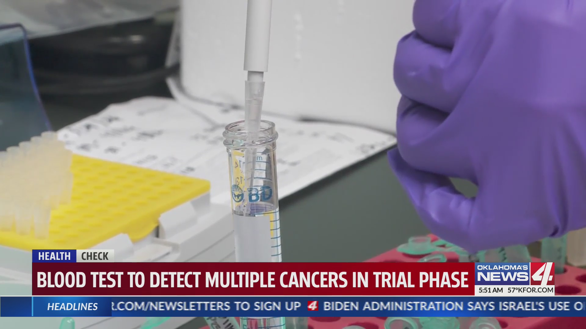 Blood draw cancer detection test in clinical trials at OU Stephenson ...
