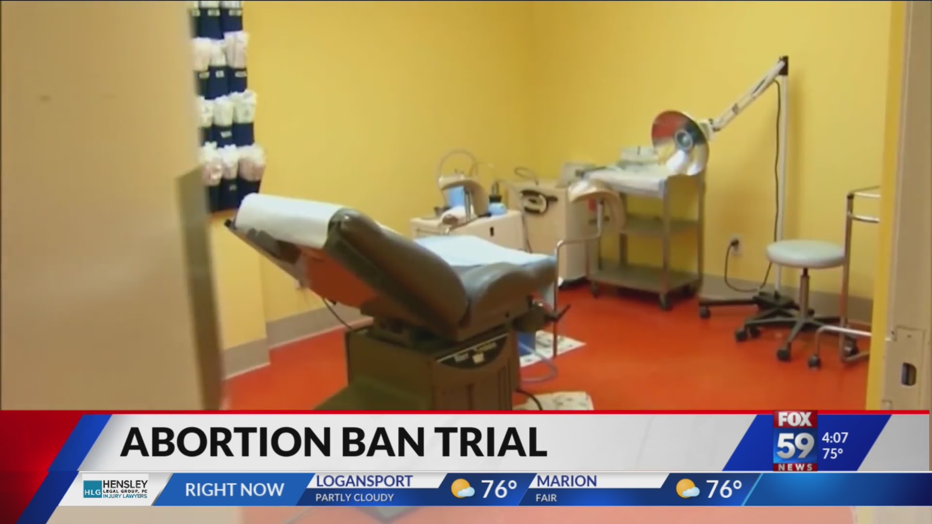 Abortion ban trial – Fox 59