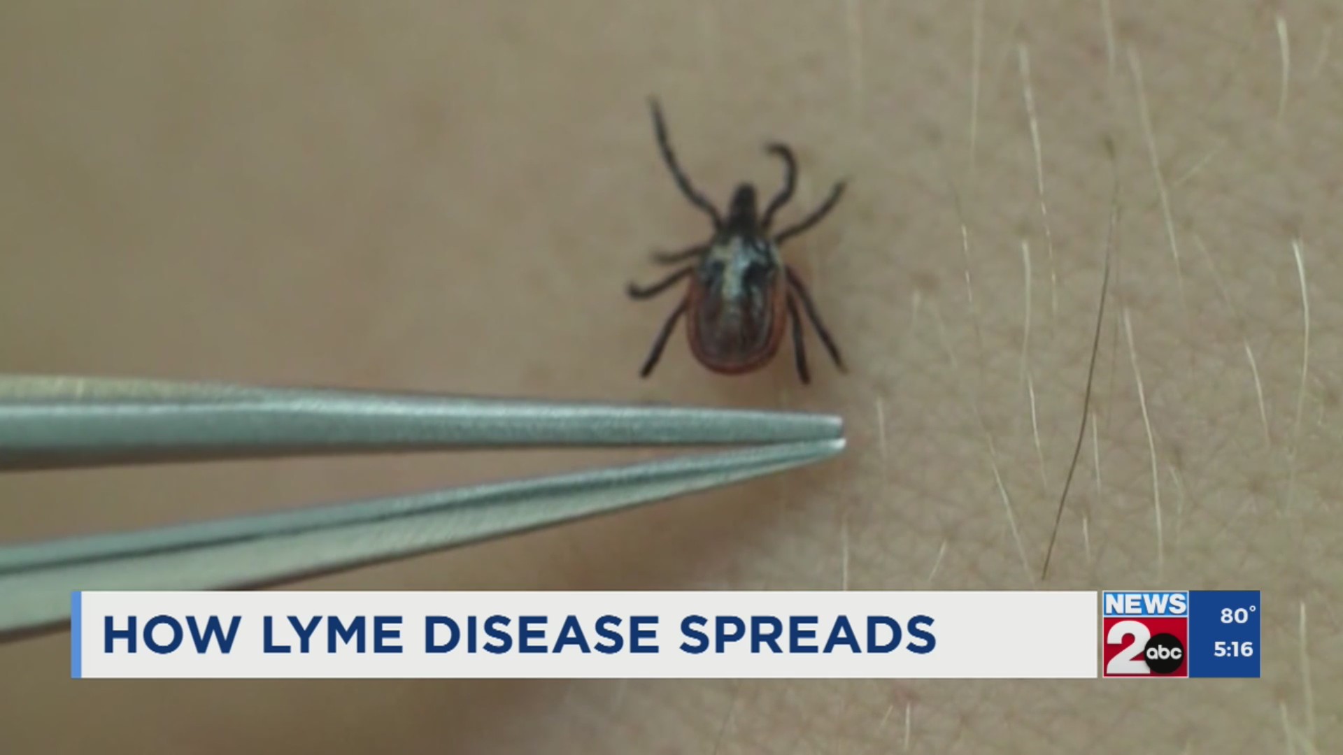 How does Lyme disease spread? – WKRN News 2