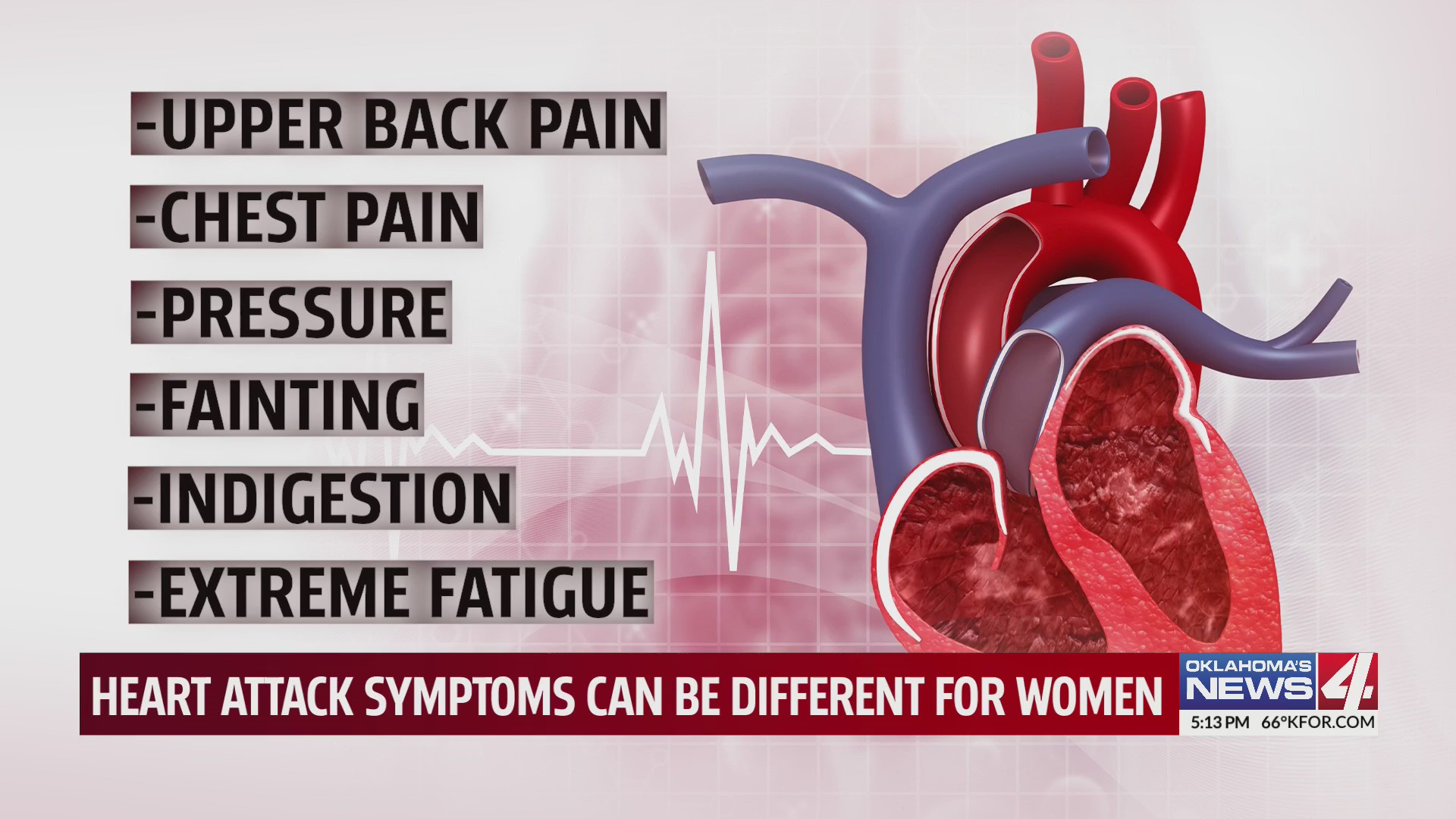 Heart attack symptoms can be different for women – KFOR.com Oklahoma City