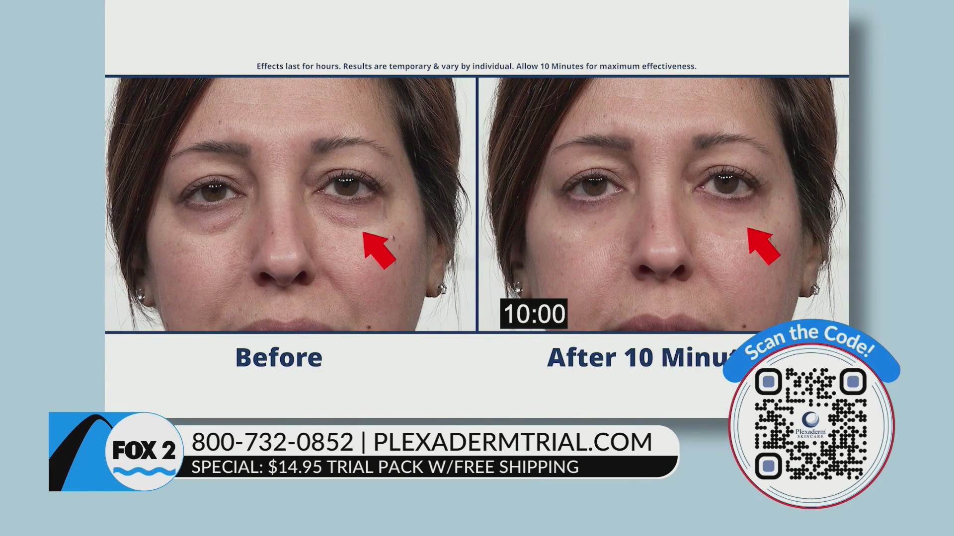 Reverse visible signs of aging with the Plexaderm 10-minute challenge! – FOX 2