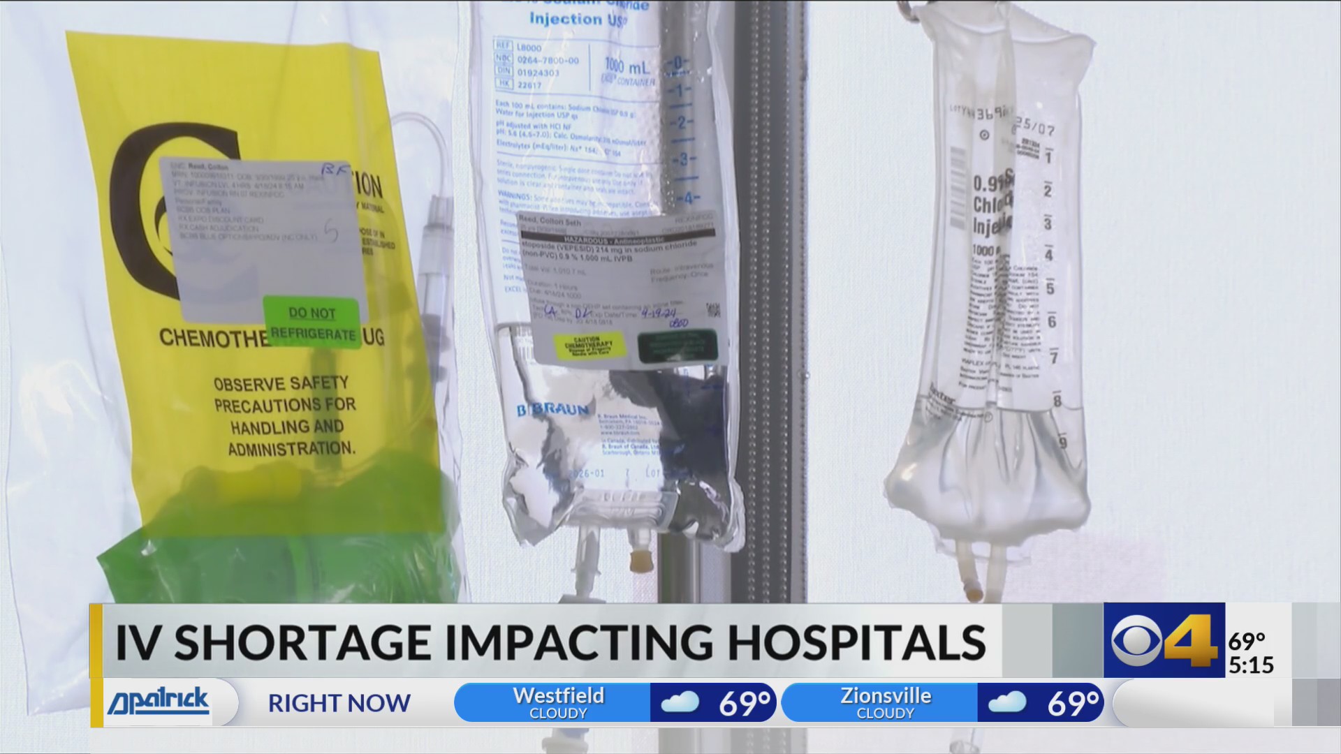IV fluid shortage impacting area hospitals – WTTV CBS4Indy