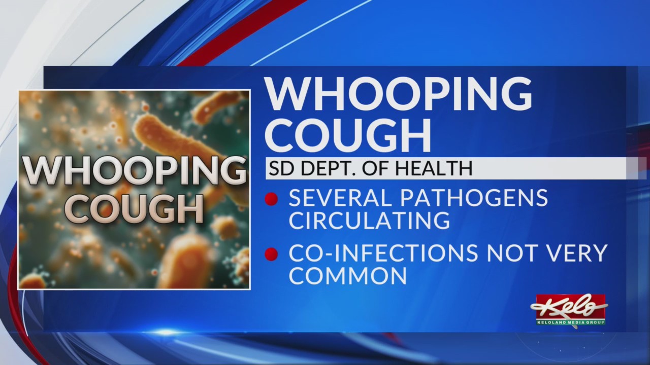 SD DOH: Flu, whooping cough risks in South Dakota – KELOLAND.com