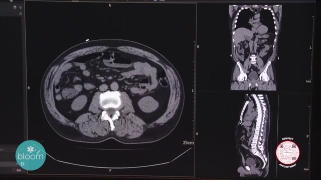 Difference between CT & MRI scans | Bloom – WFLA