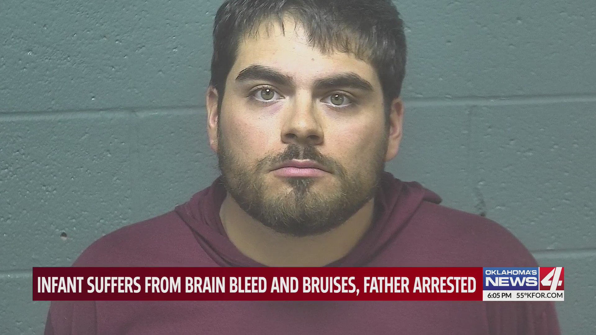 Infant suffers from brain bleed and bruises, father arrested – KFOR.com ...