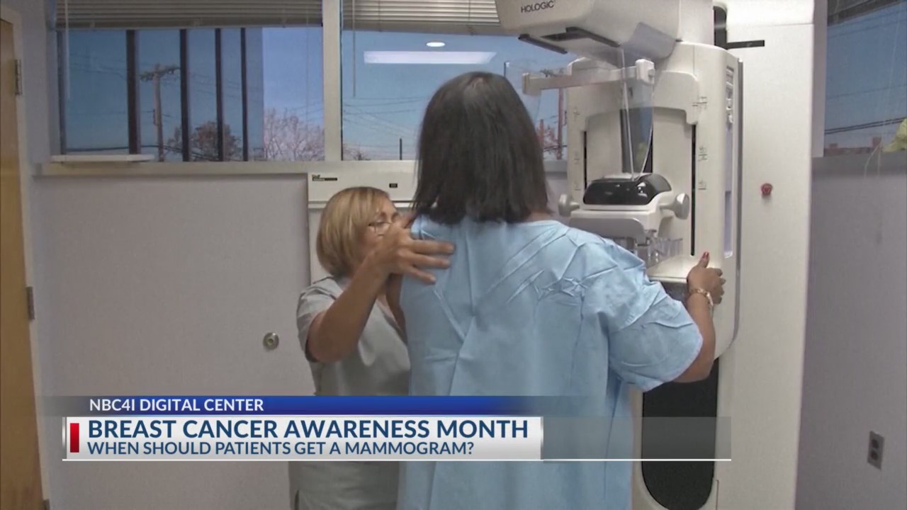 Breast cancer awareness: When should patients get mammogram? – NBC4 WCMH-TV