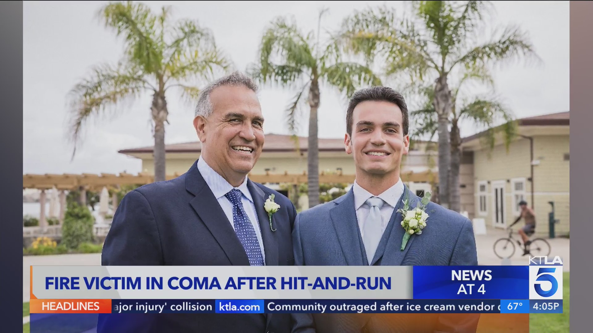 SoCal man in coma after hit-and-run crash – KTLA