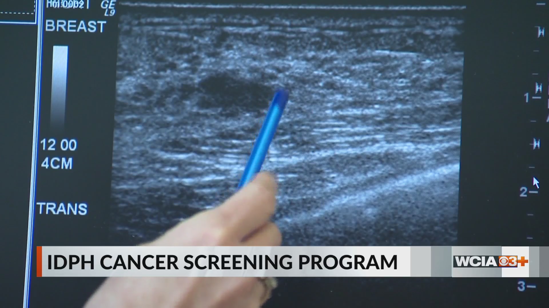 Early detection saves lives: Eligible women in Illinois can receive ...