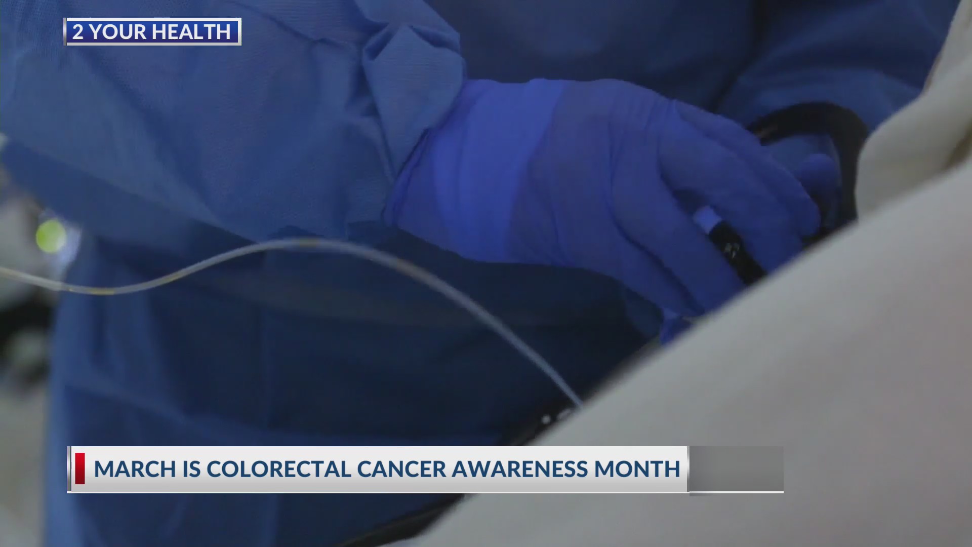 2 Your Health: Scoring system could help identify colorectal cancer ...