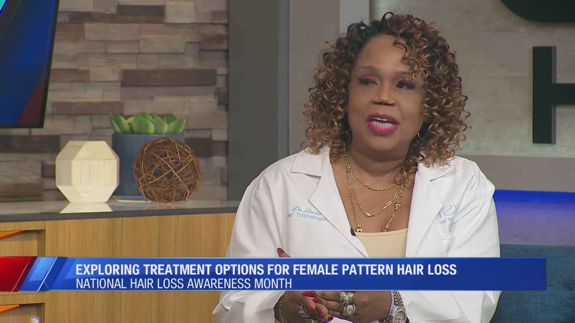 Explore treatment options for female pattern hair loss | CW39 Houston ...