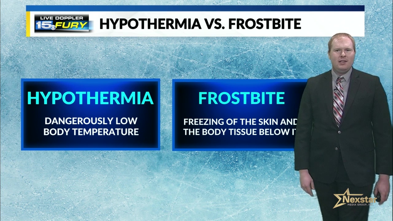 Hypothermia vs. Frostbite – WRBL