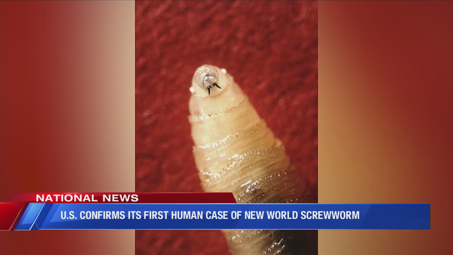 U.S. confirms its first human case of new world screwworm – WFXRtv