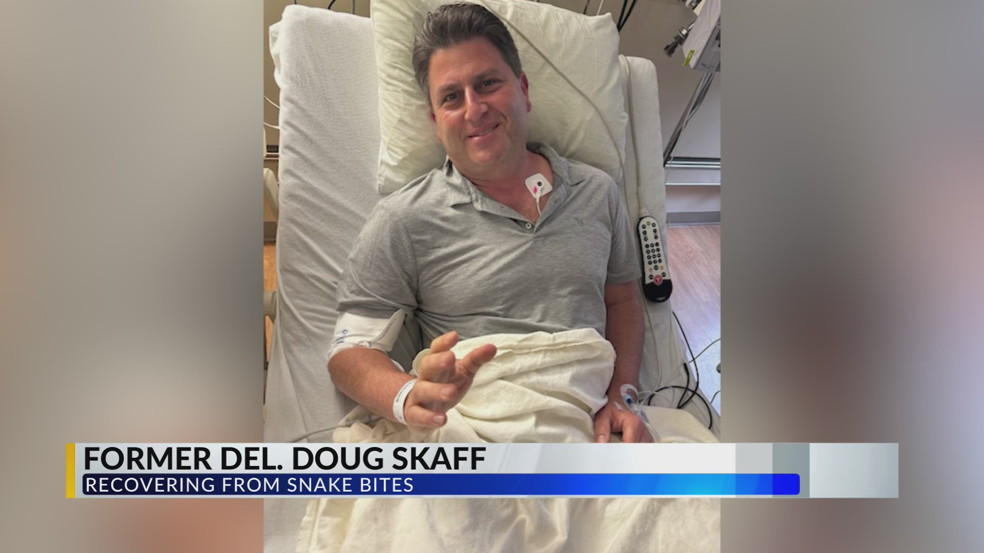 Former West Virginia House Minority Leader Doug Skaff Jr. bitten by ...